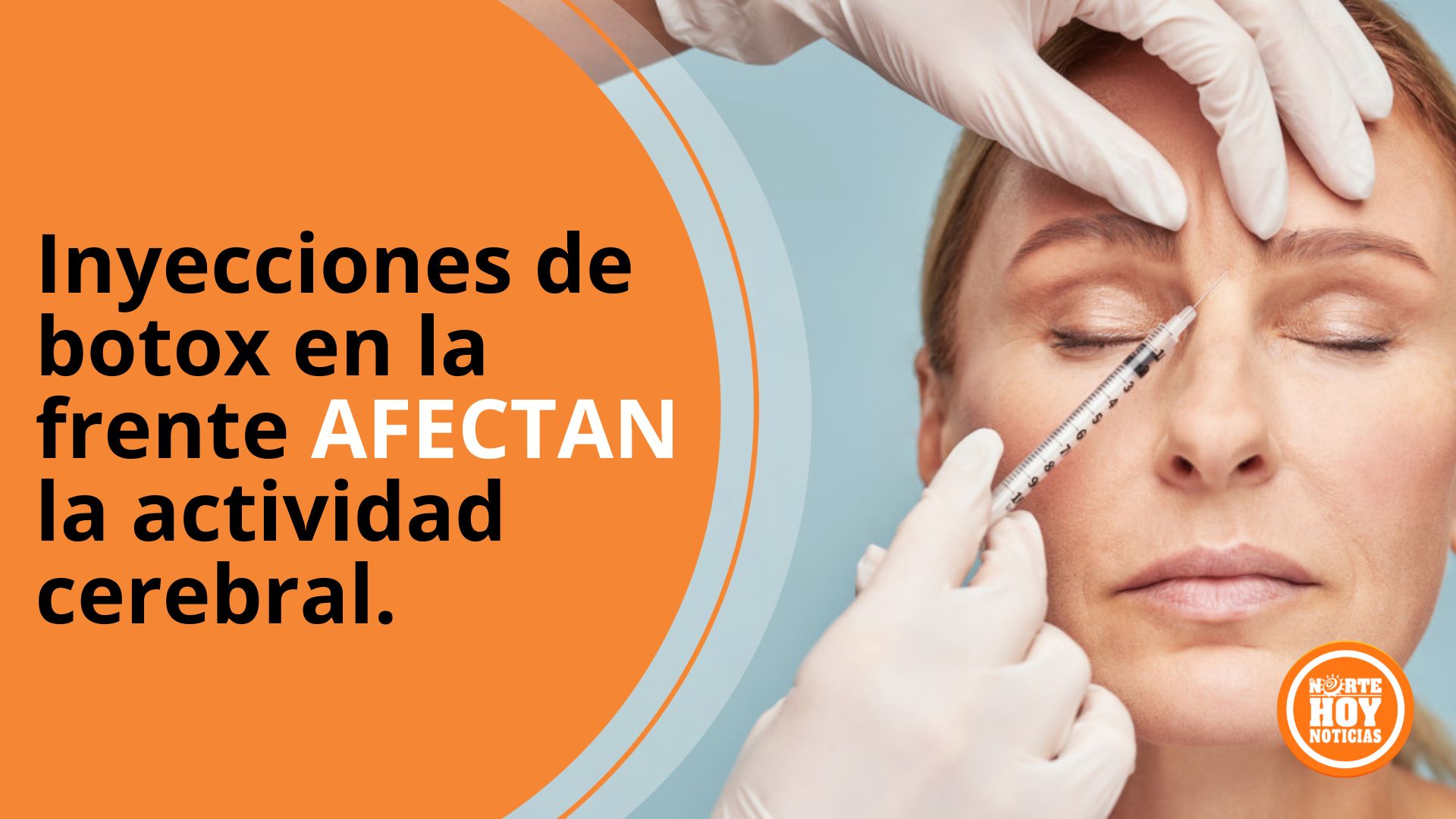 Inyecciones de botox en la frente afectan la actividad cerebral. - El ...