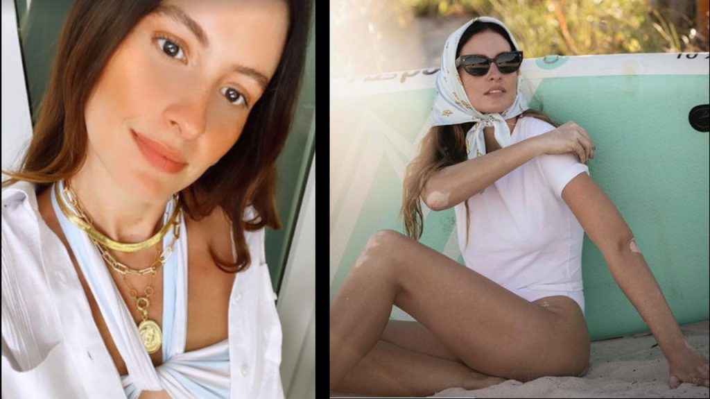 ¿Cuál es la rara enfermedad que tiene Taliana Vargas? - El Norte Hoy